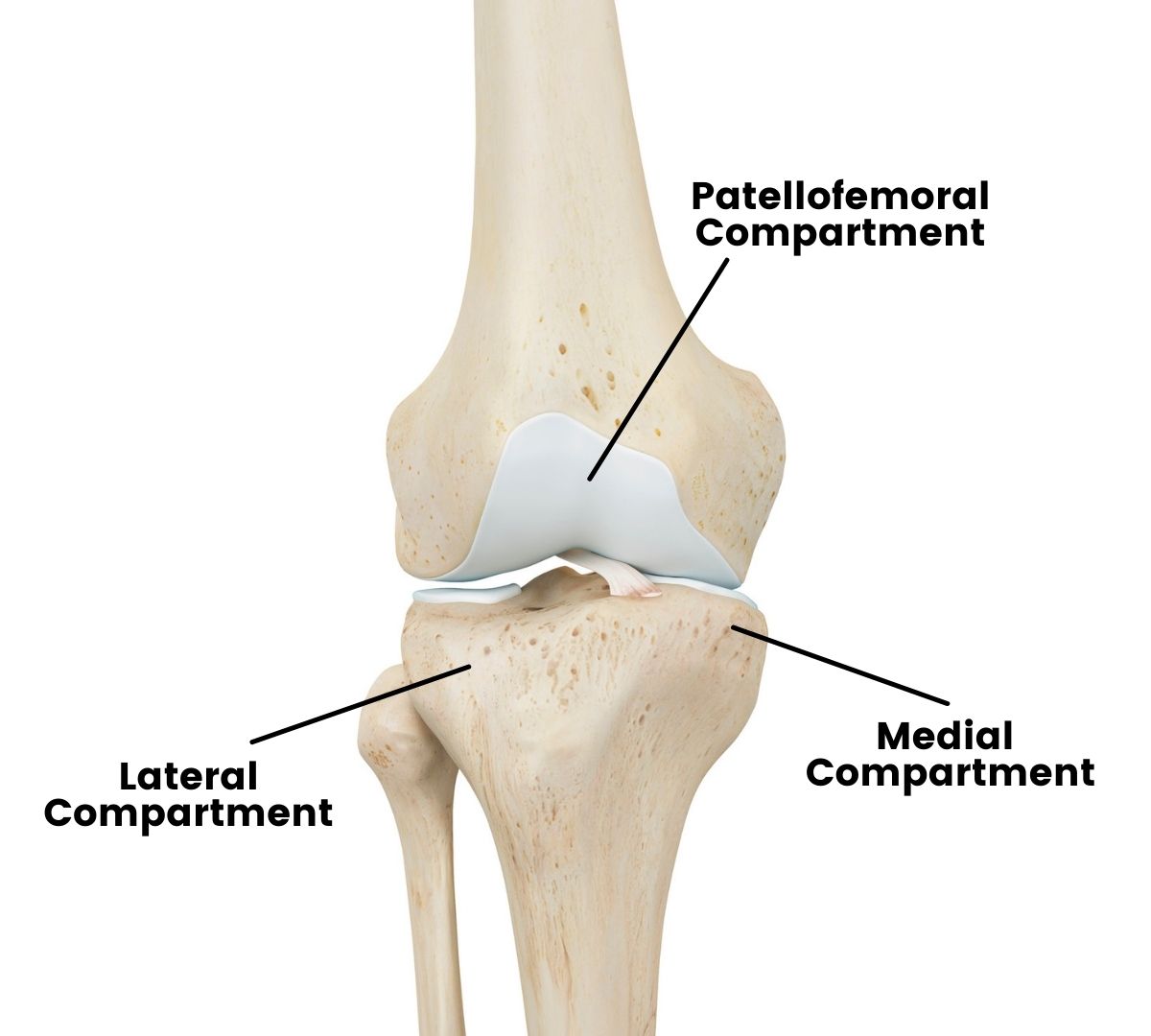 Partial (Uni-Compartmental) Knee Replacement - Jason Hockings